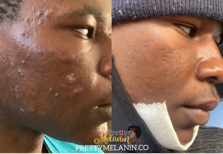 Pretty Melanin Skincare – prettymelaninskincare