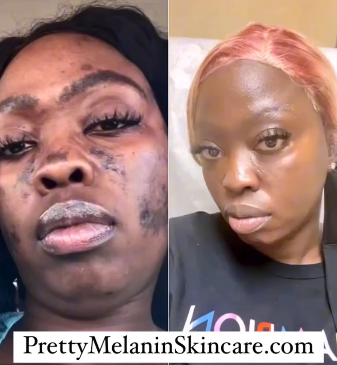 Pretty Melanin Skincare – prettymelaninskincare