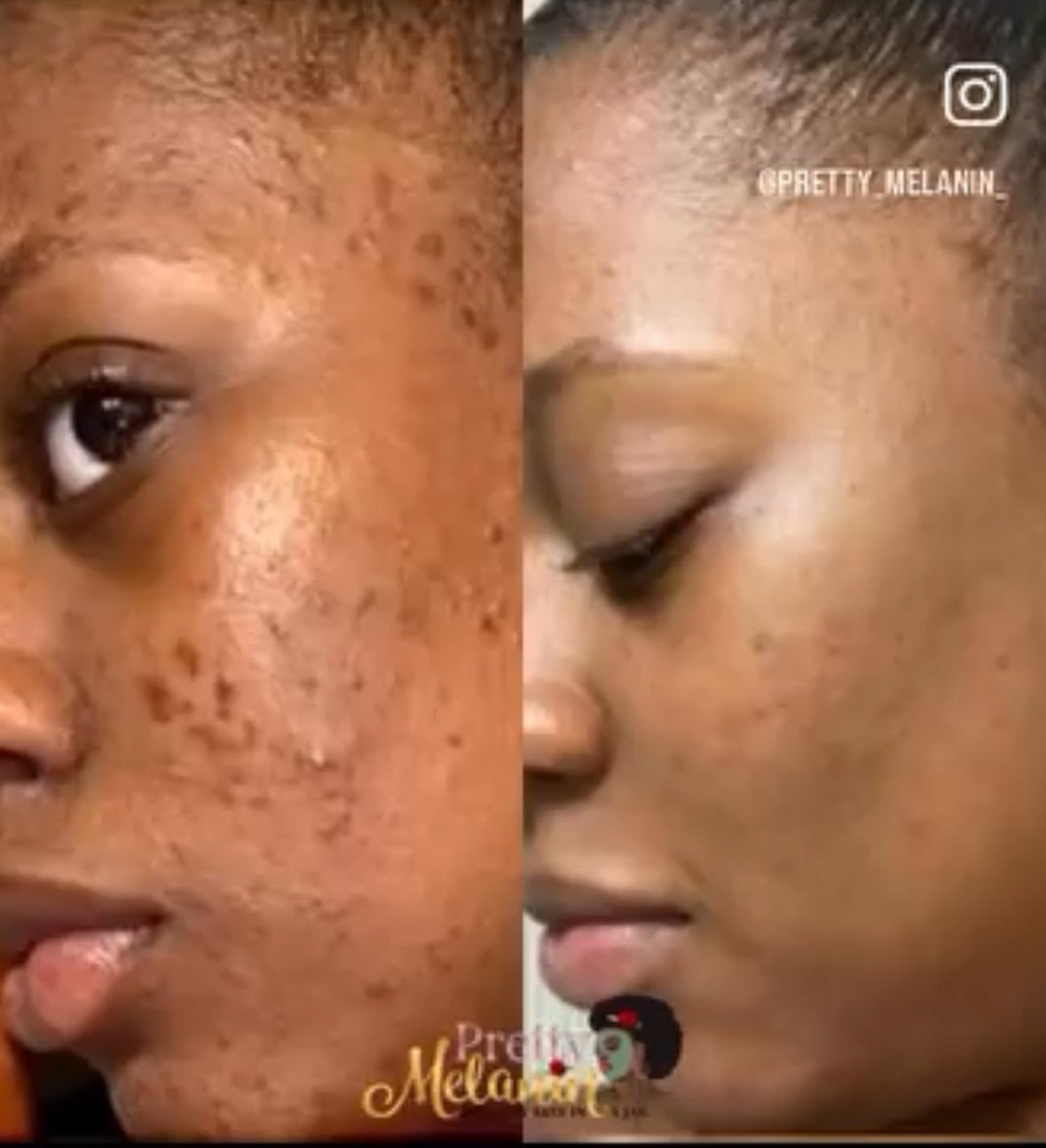 Pretty Melanin Skincare – prettymelaninskincare