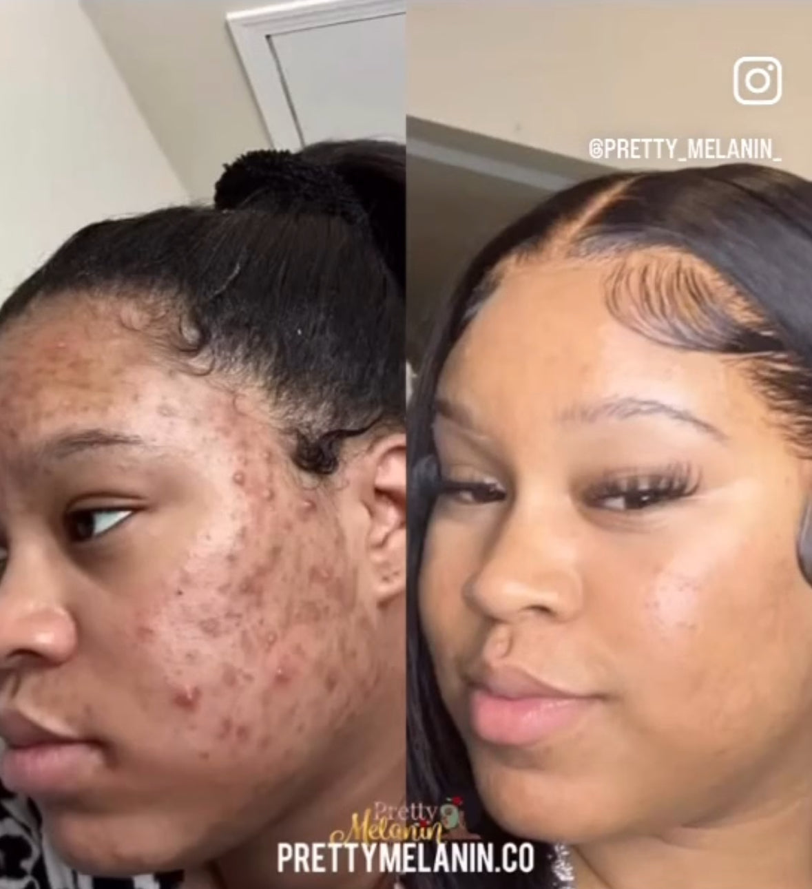 Pretty Melanin Skincare – prettymelaninskincare