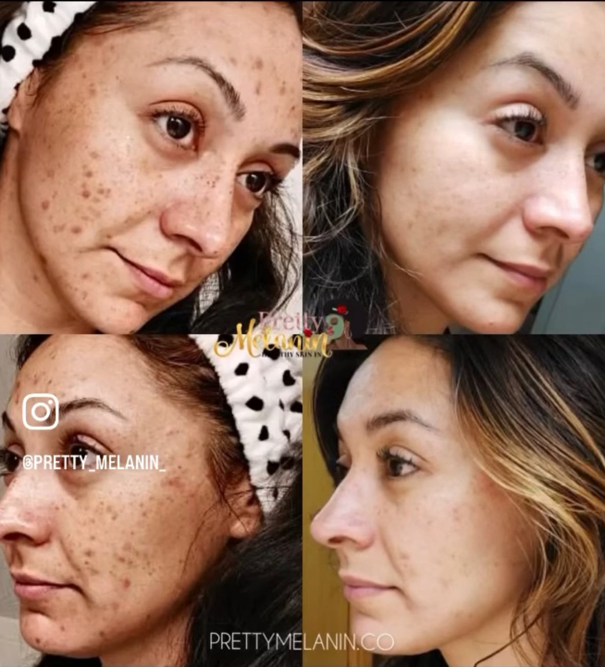 Pretty Melanin Skincare – prettymelaninskincare