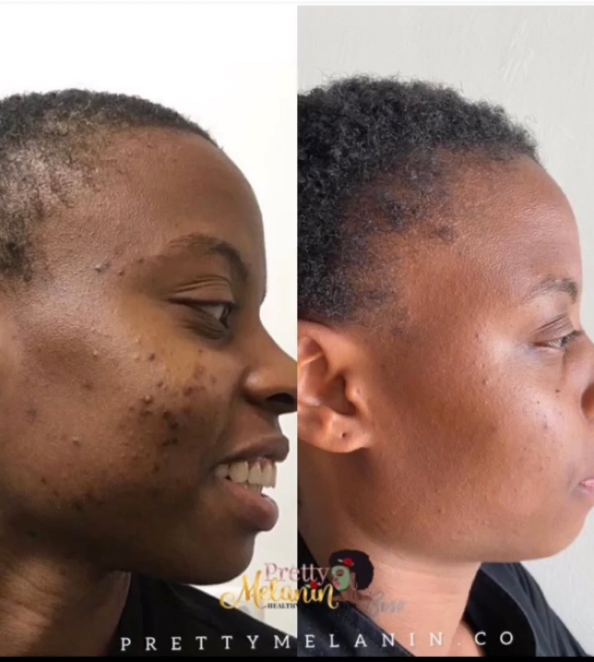 Pretty Melanin Skincare – prettymelaninskincare