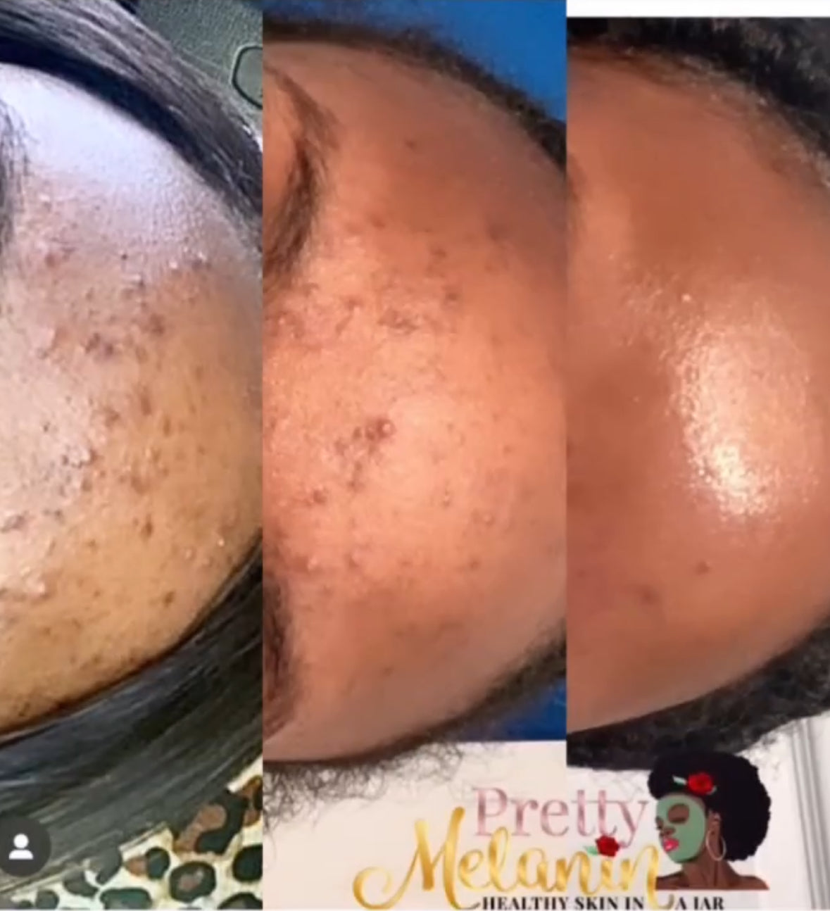 Pretty Melanin Skincare – prettymelaninskincare