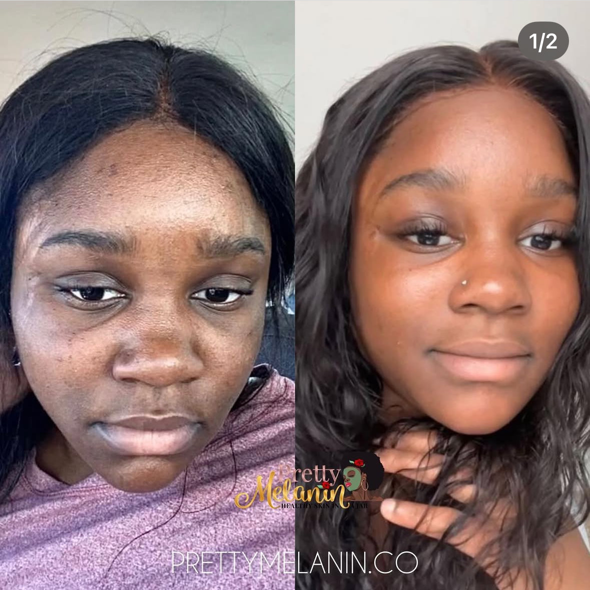 Pretty Melanin Skincare – prettymelaninskincare