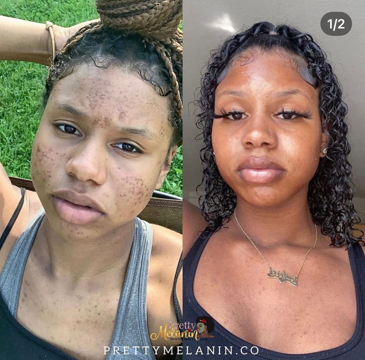 Pretty Melanin Skincare – prettymelaninskincare