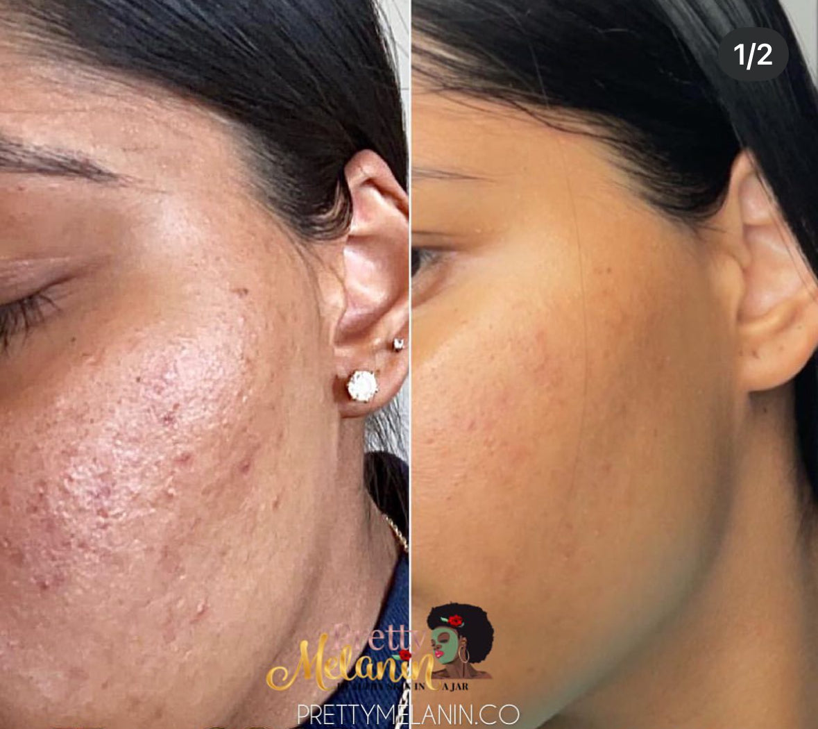 Pretty Melanin Skincare – prettymelaninskincare