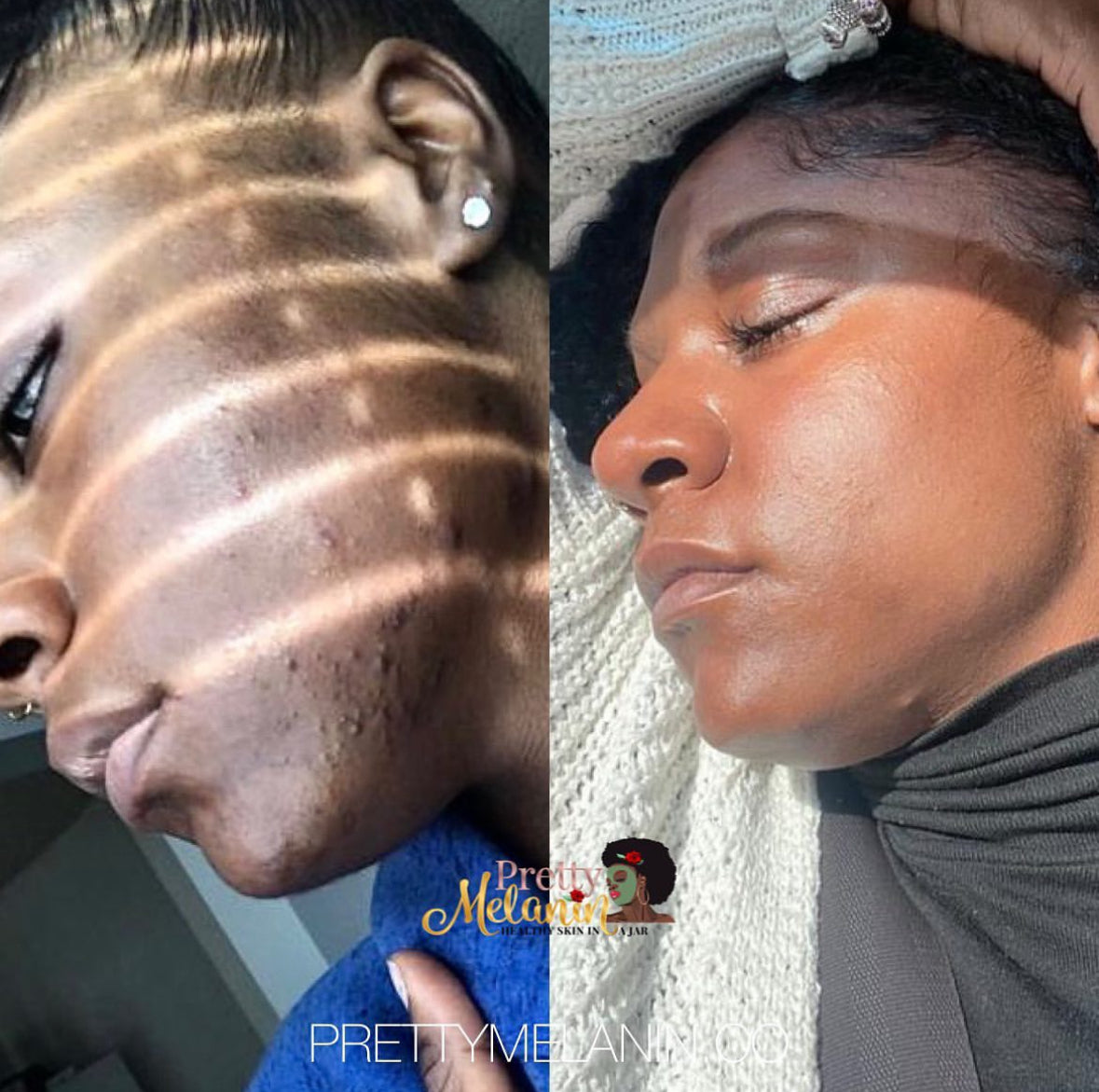 Pretty Melanin Skincare – prettymelaninskincare