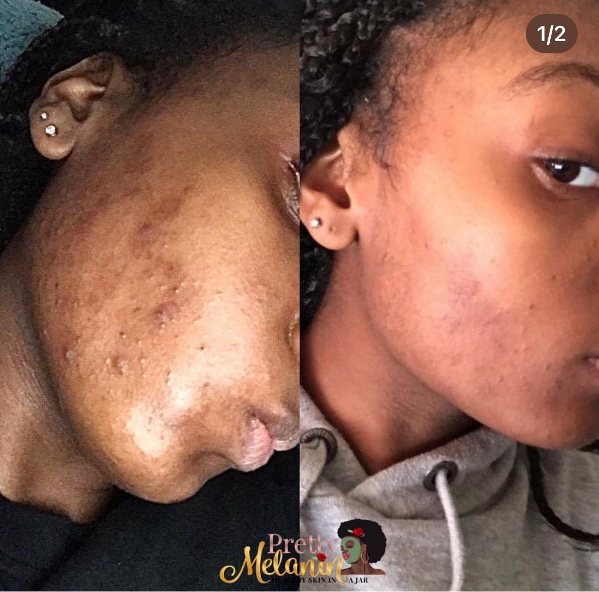 Pretty Melanin Skincare – prettymelaninskincare