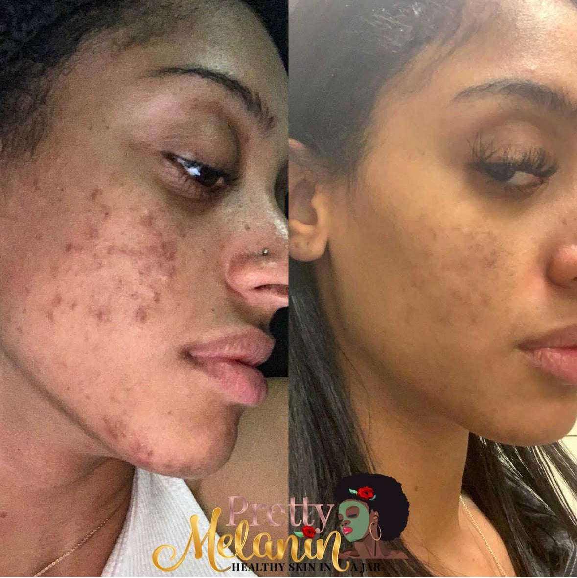 Pretty Melanin Skincare – prettymelaninskincare