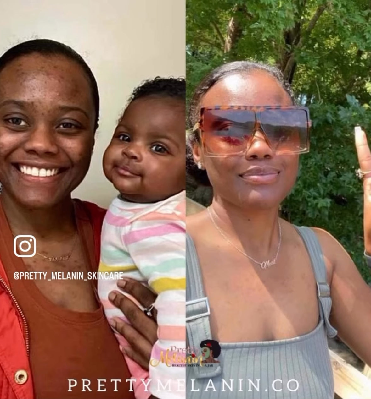 Pretty Melanin Skincare – prettymelaninskincare