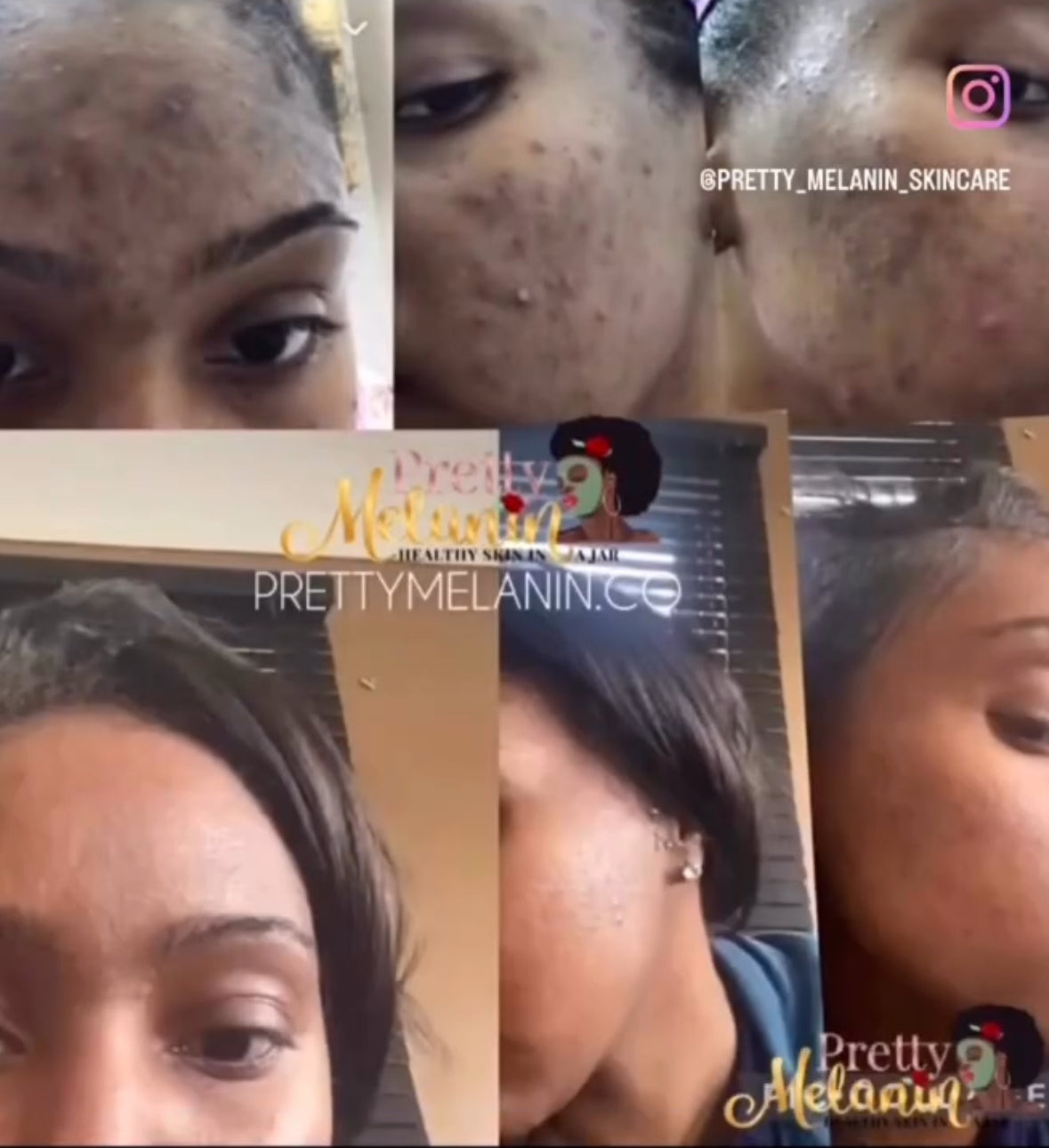 Pretty Melanin Skincare – prettymelaninskincare